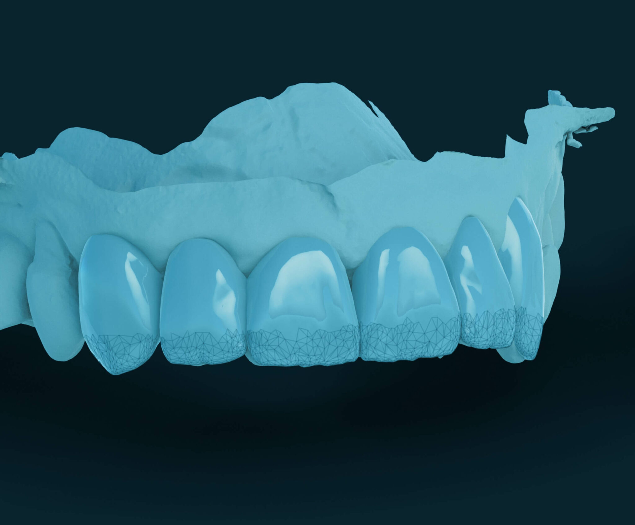 BlenderDentSchool • Blender Dent School